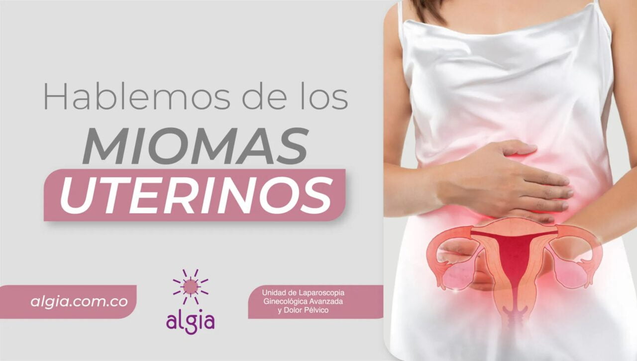 Hablemos de miomas uterinos - Algia Pereira